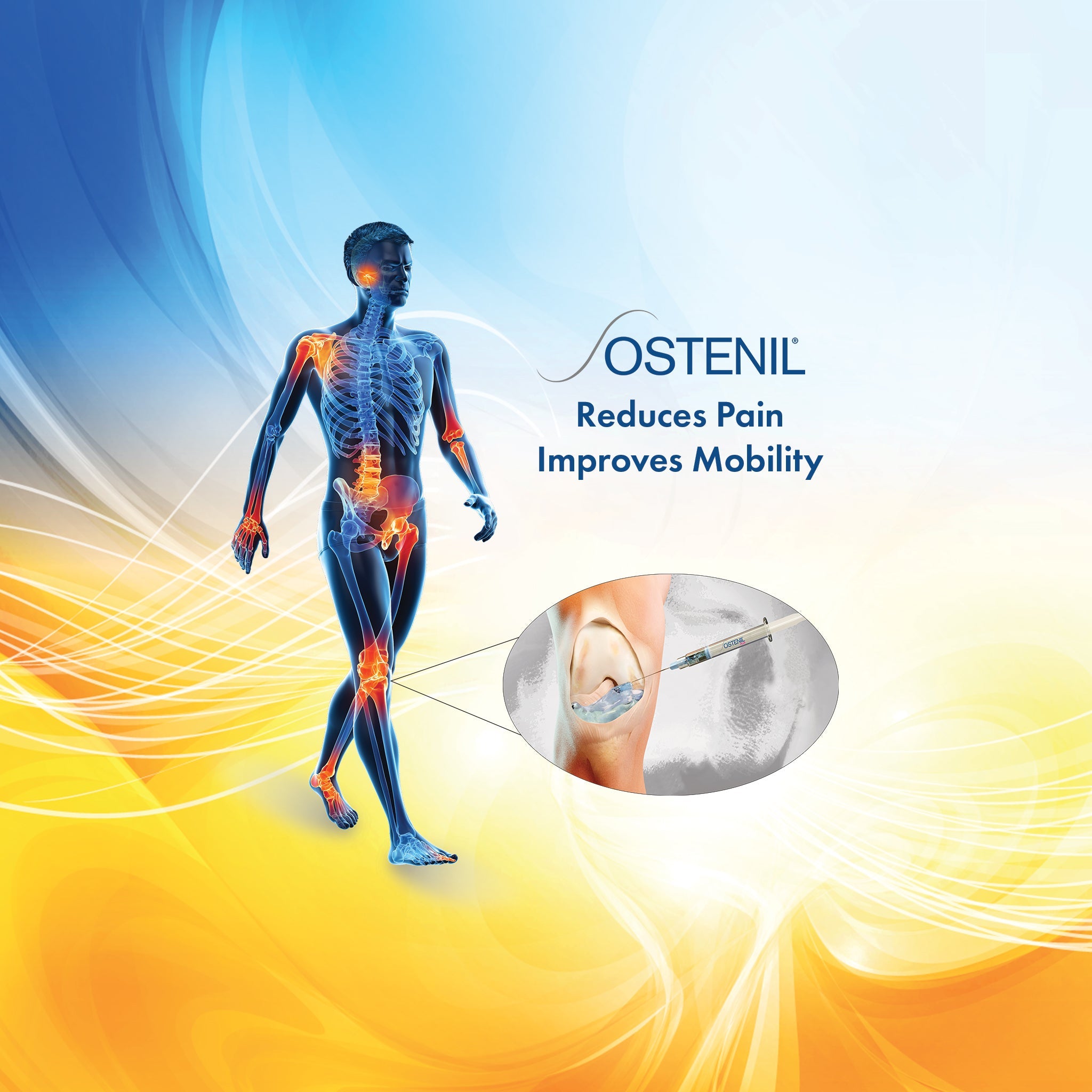 OSTENIL – TRB Chemedica